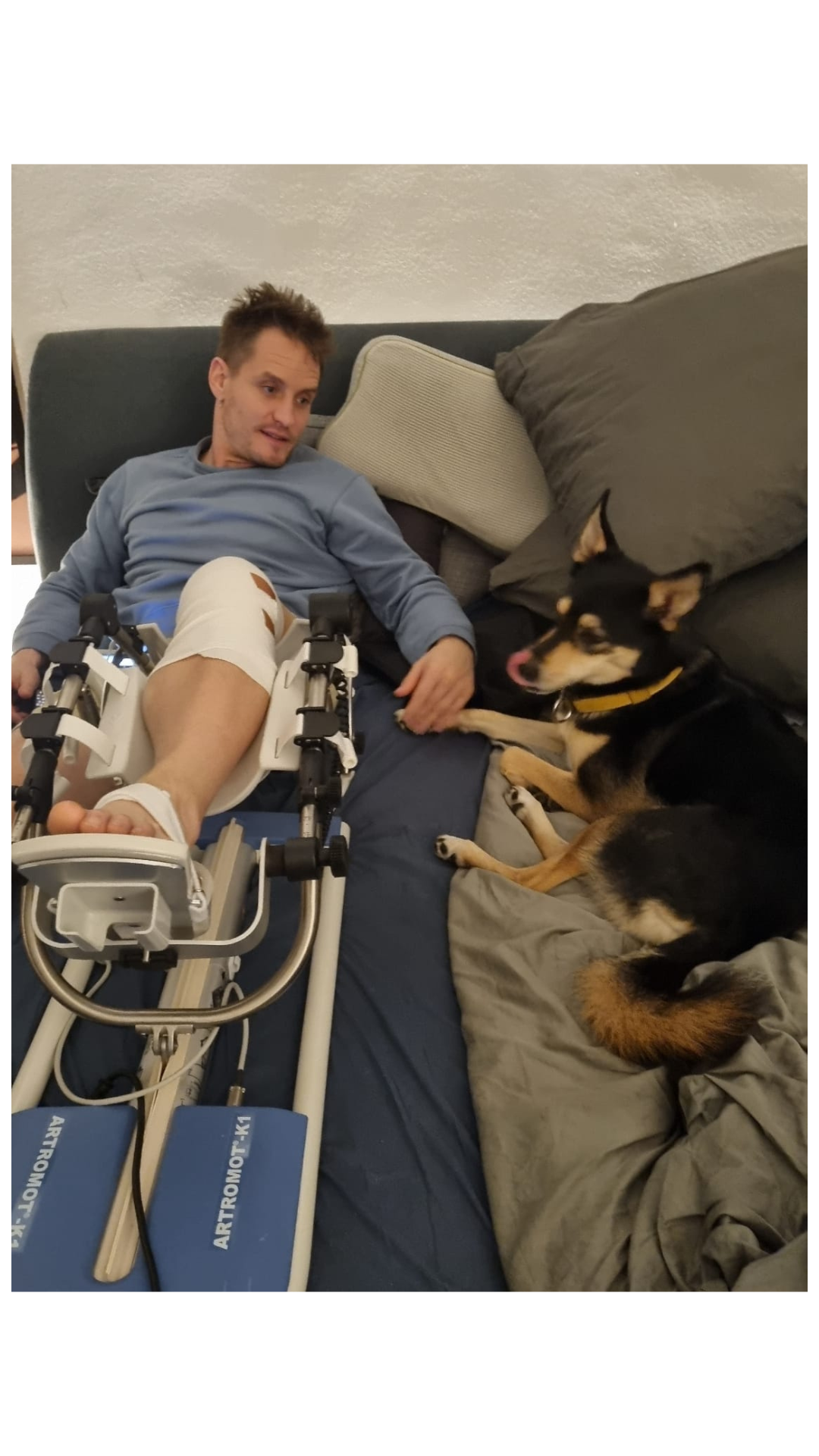 The Complete Recovery Program for Tibial Plateau, Leg, and ORIF