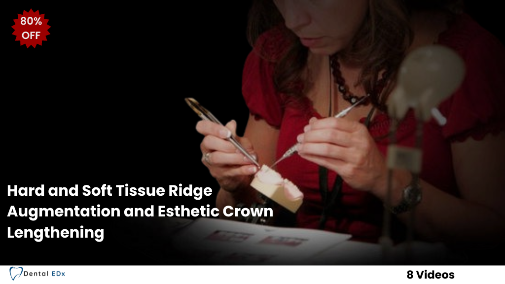 Hard and Soft Tissue Ridge Augmentation and Esthetic Crown Lengthening
