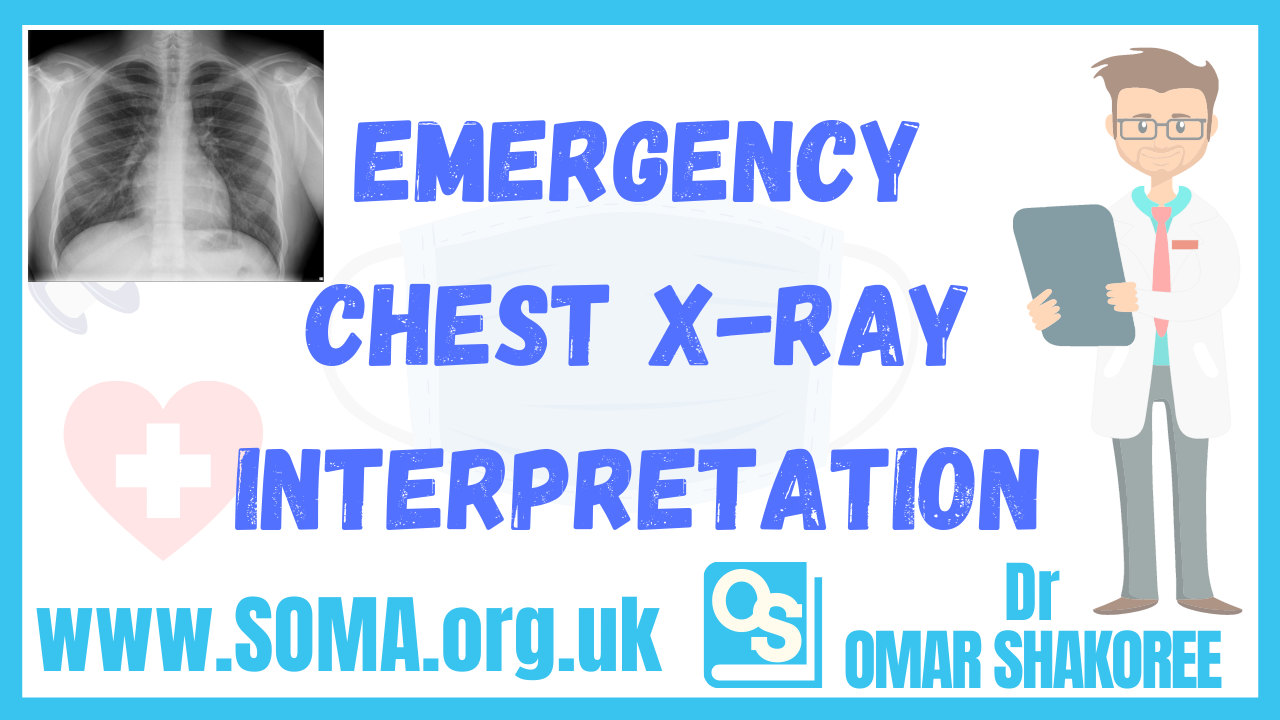 Emergency Chest X-Ray Interpretation | Shakoree Online Medical Academy